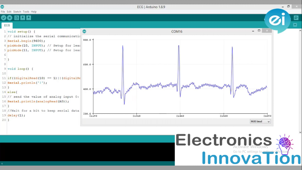 Low Cost Ad8232 Based Ecg And Heart Monitoring System Using Arduino Electronics Innovation